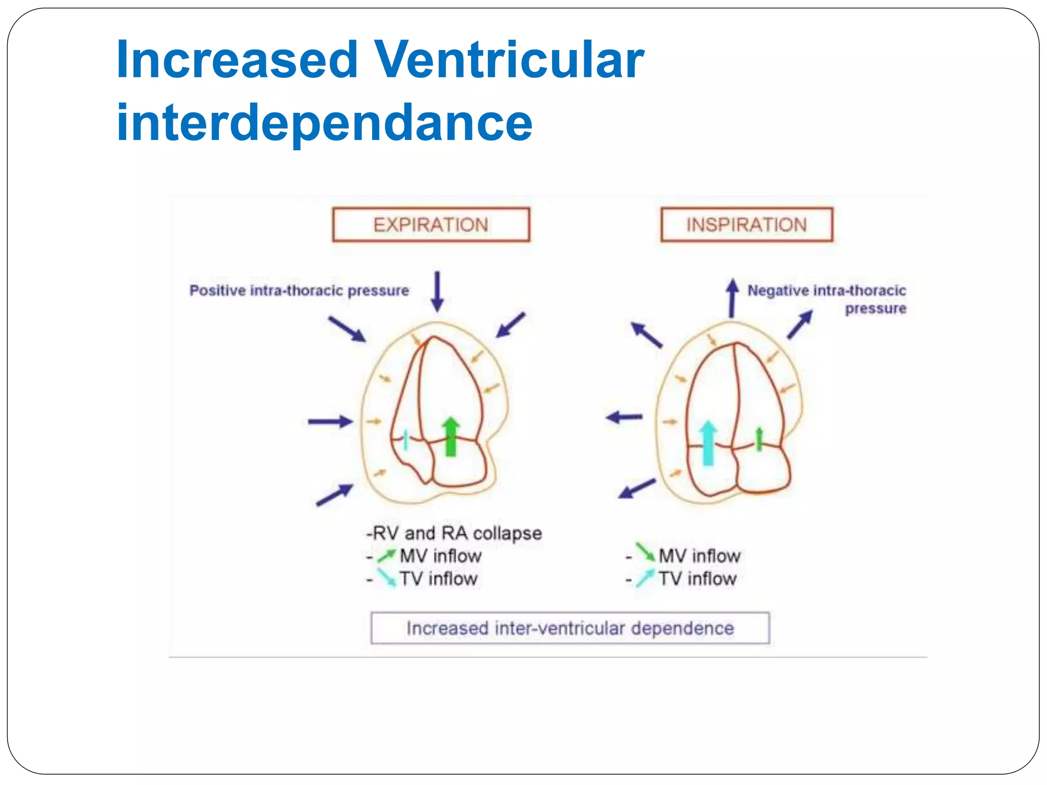 Icu echocardiography | PPTX