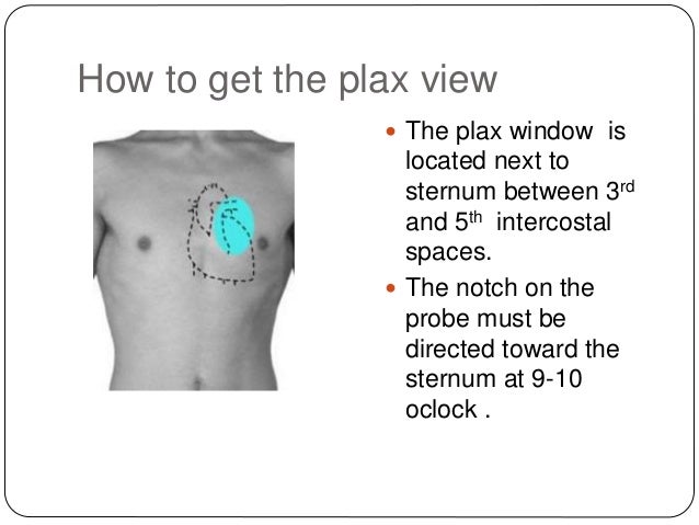 Icu echocardiography