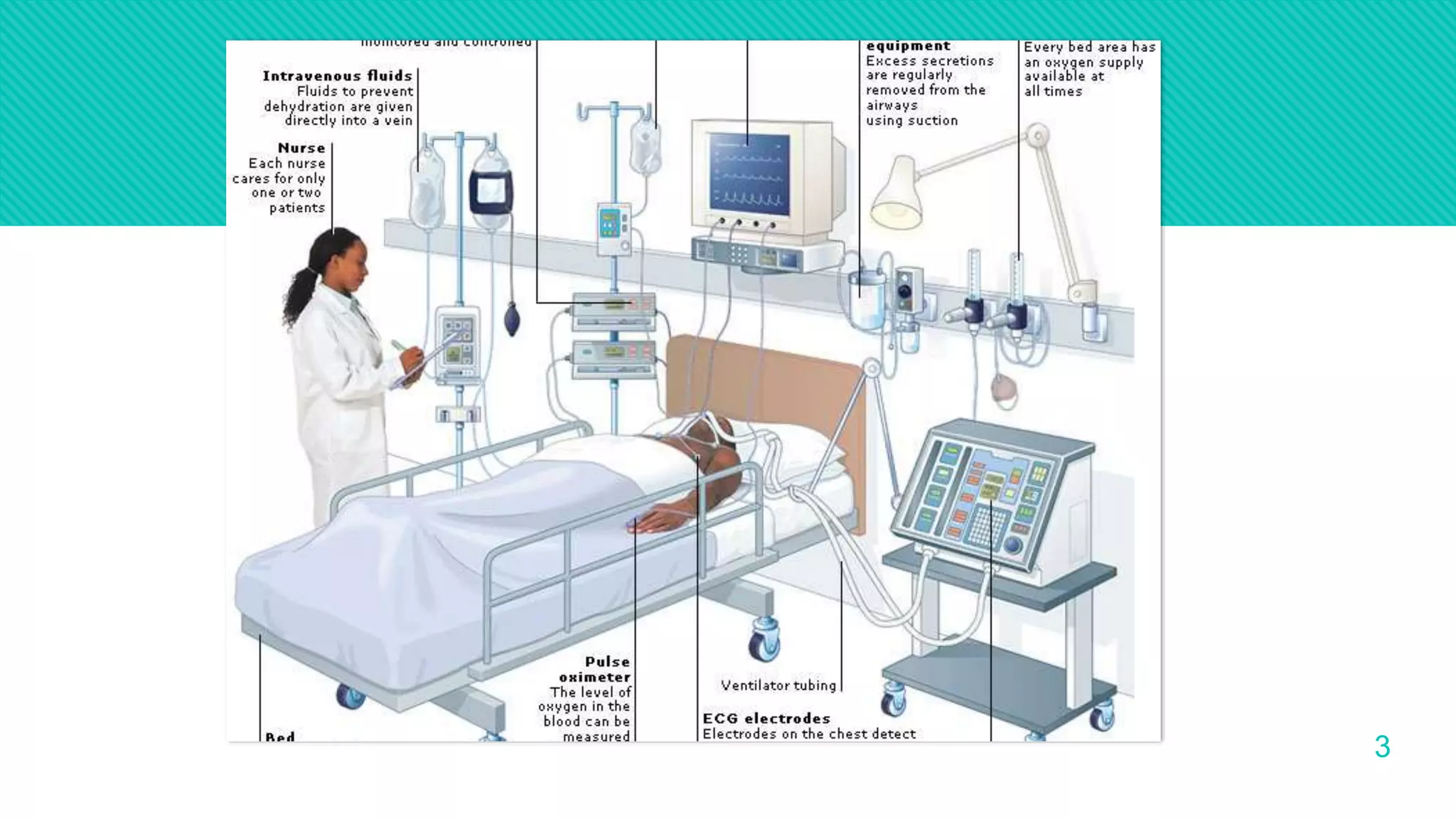 ICU AND IT'S TYPES | PPTX