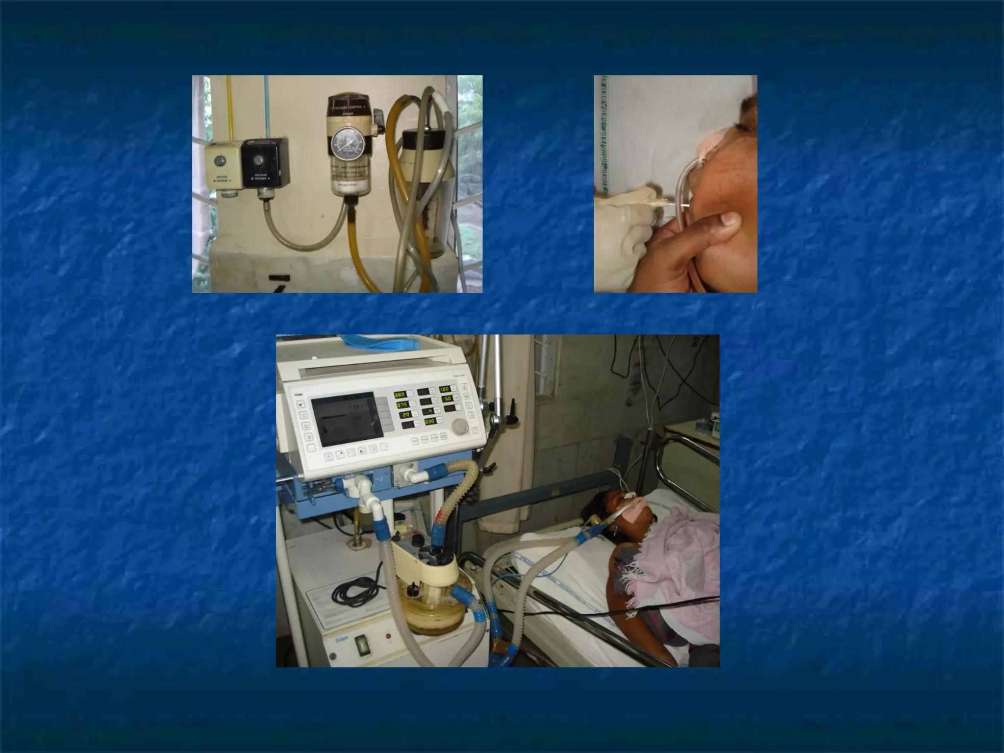 ICU management | PPT