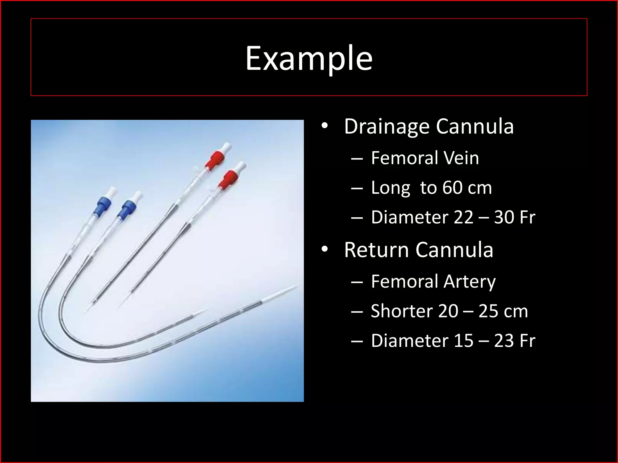 ICU management of ECMO pt | PPSX