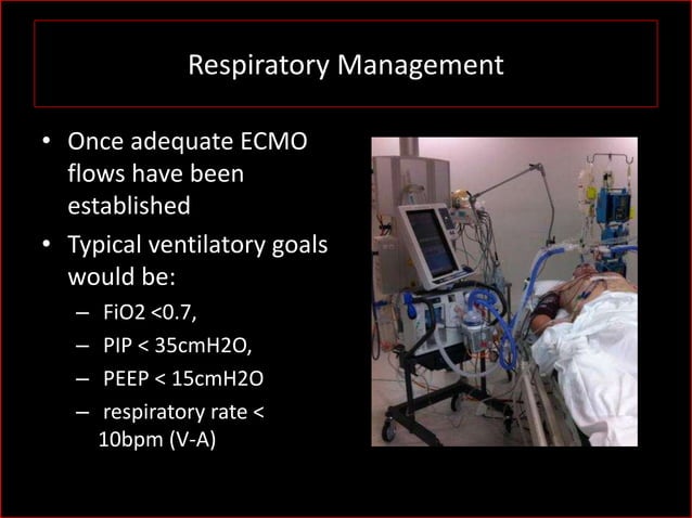 ICU management of ECMO pt | PPT