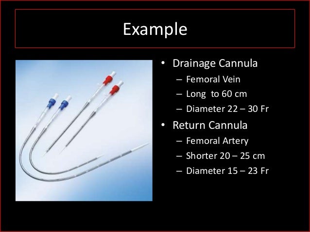 ICU management of ECMO pt