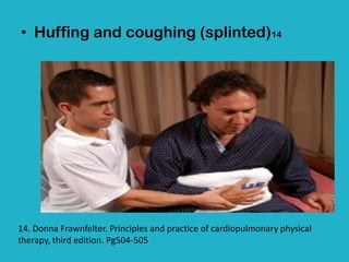 Icu management of respiratory surgeries | PDF