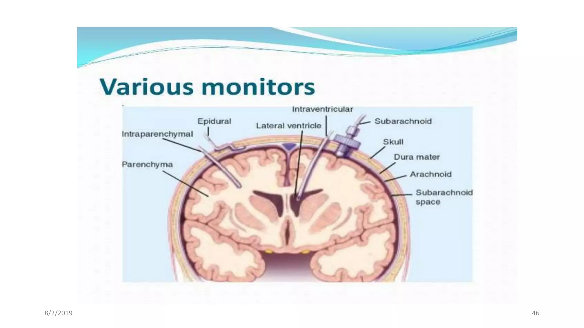 ICU management of traumatic brain injury | PPTX