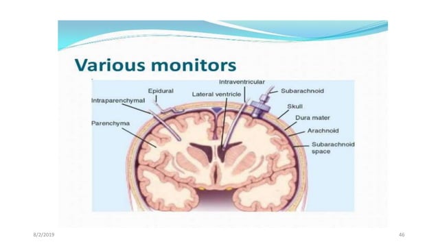 ICU management of traumatic brain injury | PPTX | First Aid | Injuries