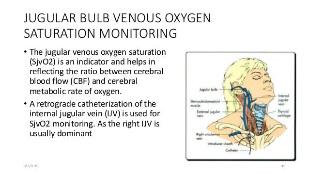 ICU management of traumatic brain injury