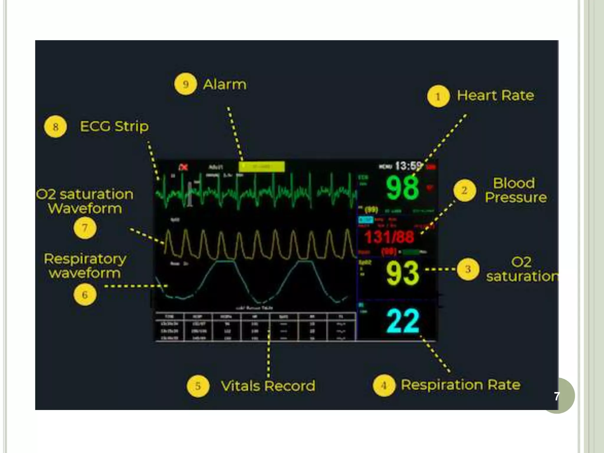 Icu monitoring | PPTX