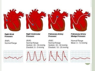 Icu monitoring | PPTX