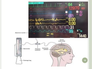 Icu monitoring | PPTX