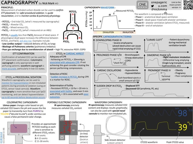 ICU_one_pager_end_tidal_co2.pptx