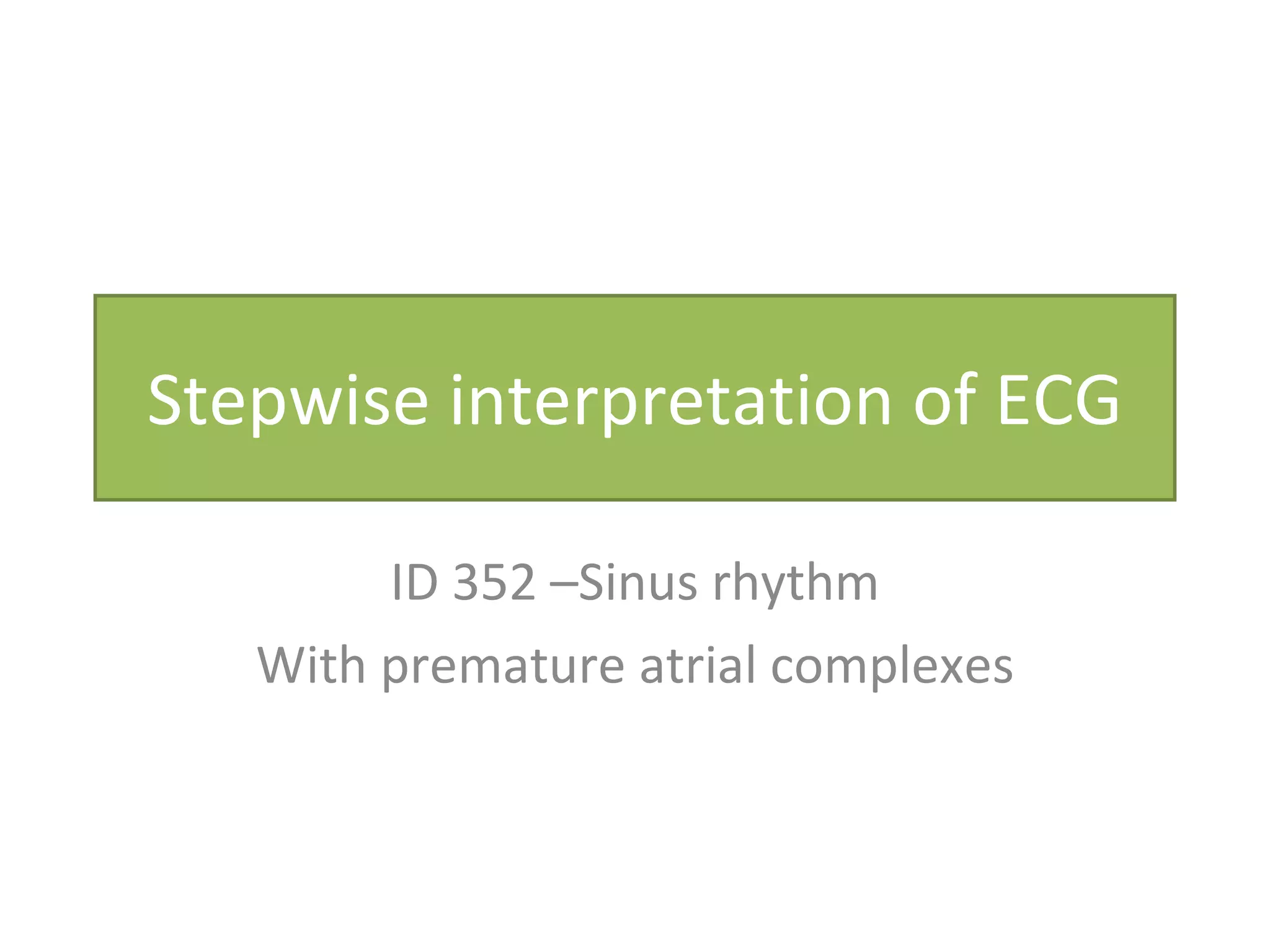 ID 352 –Sinus rhythm With premature atrial complex | PPT