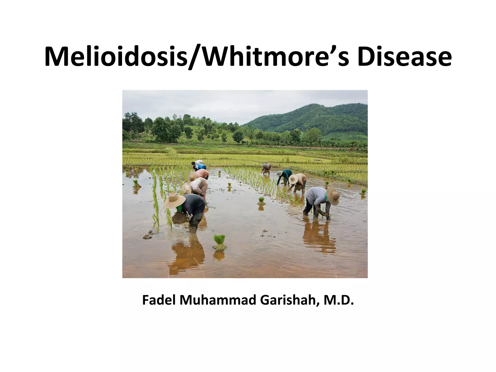 Melioidosis, Whitmore's disease | PDF