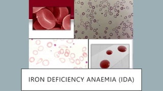 Iron Deficiency anemia powerpoint presentation | PPTX