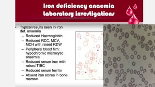 Iron Deficiency anemia powerpoint presentation | PPTX