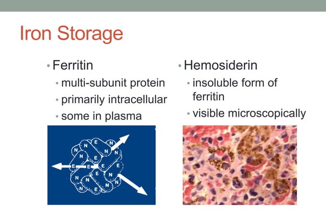 Iron deficiency anemia management, risk factors, physiology of iron ...