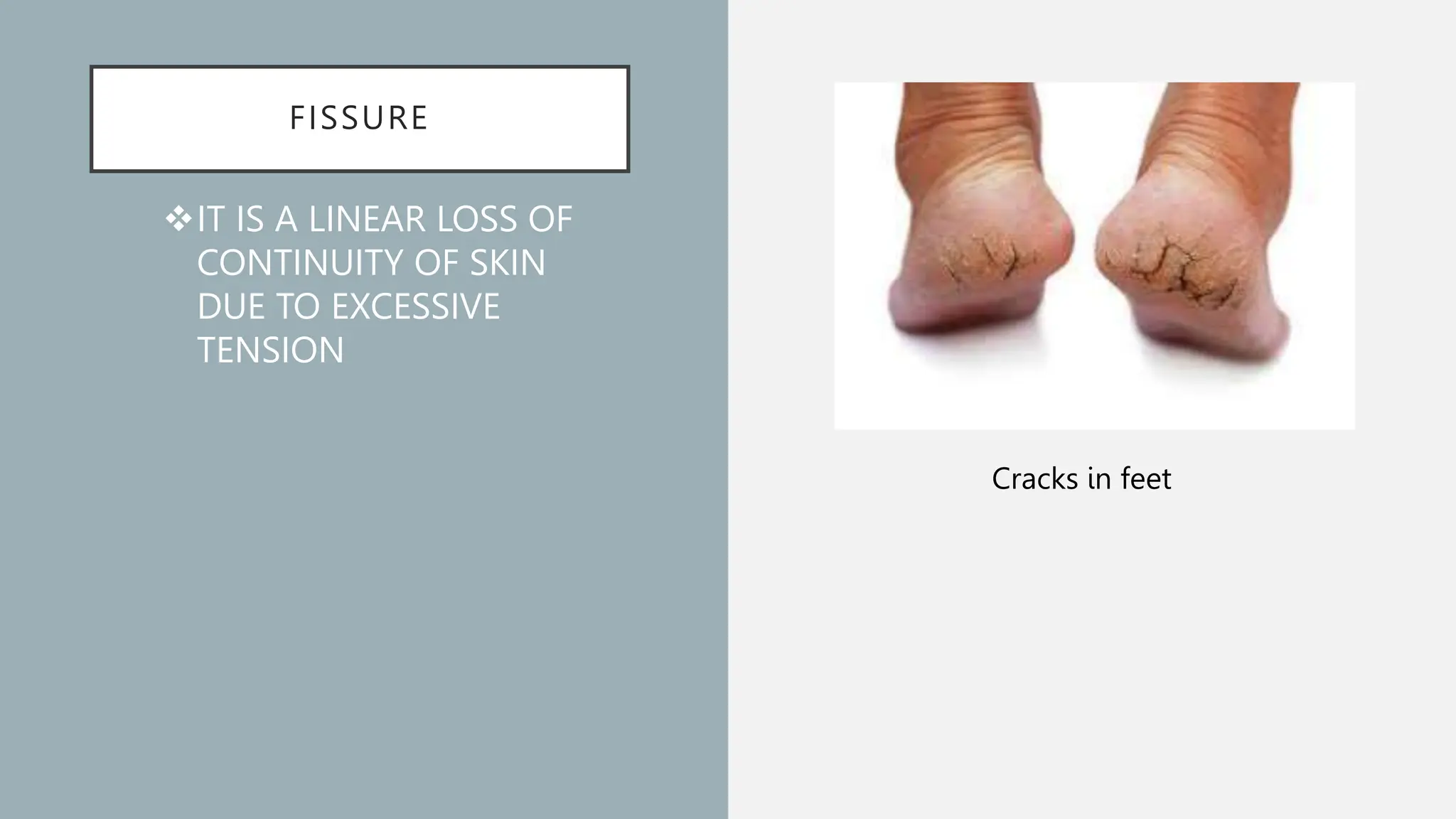 Dermatology. Basic skin leisons ( primary and secondary)pptx | PPTX