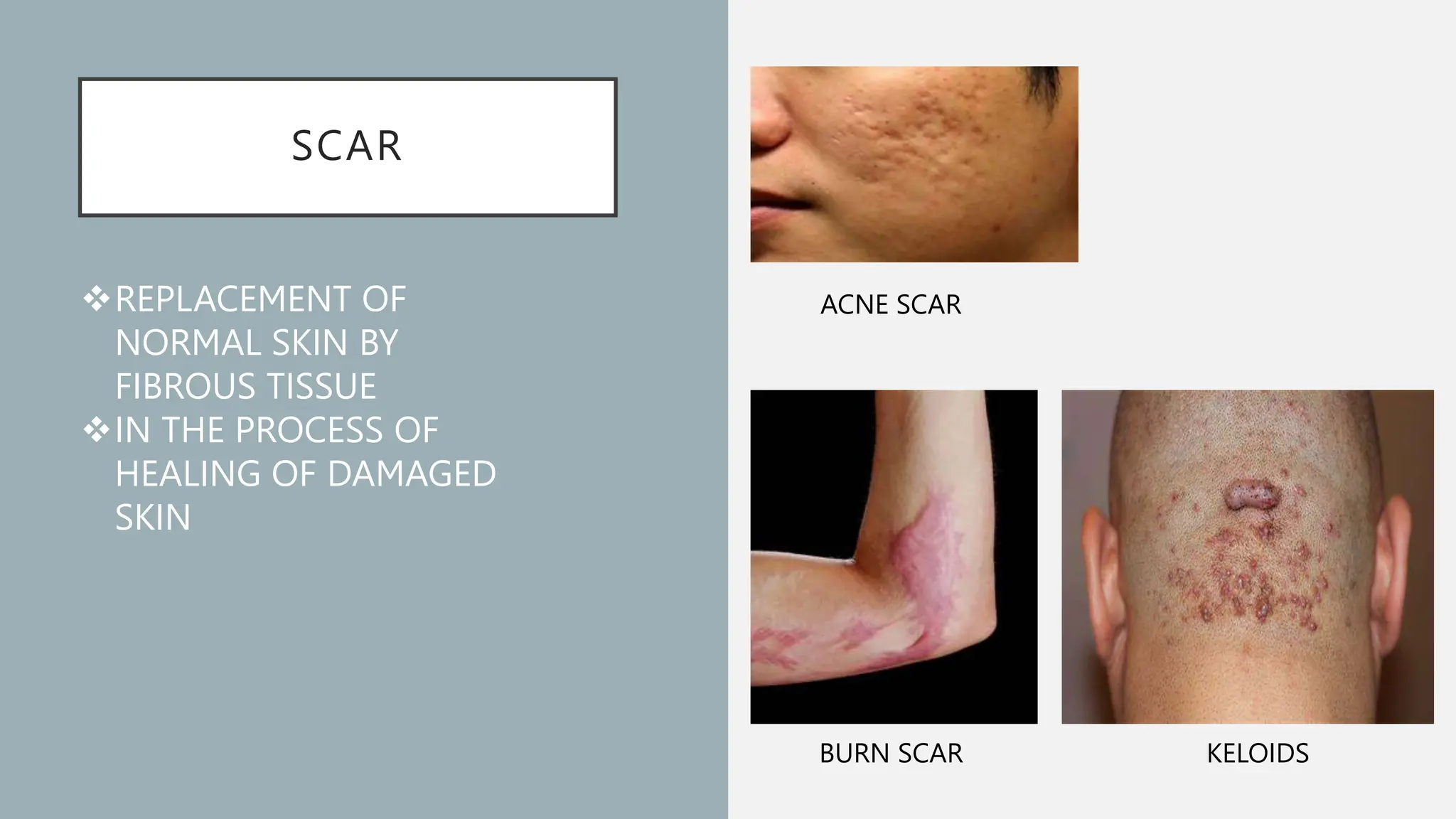 Dermatology. Basic skin leisons ( primary and secondary)pptx | PPTX