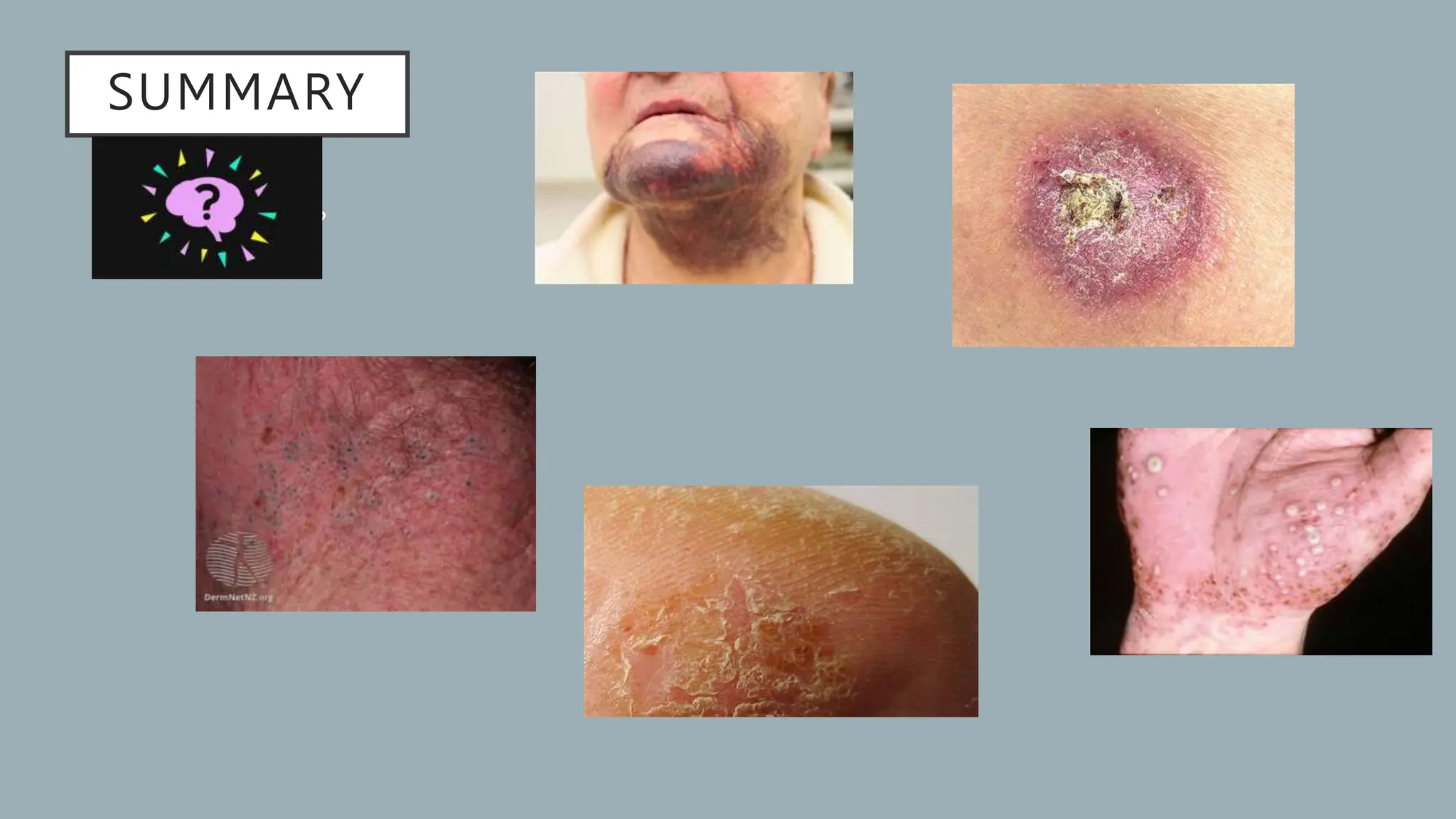 Dermatology. Basic skin leisons ( primary and secondary)pptx | PPTX
