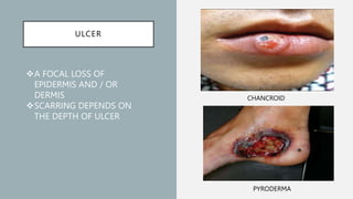 Dermatology. Basic skin leisons ( primary and secondary)pptx | PPTX