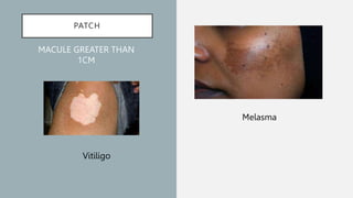 Dermatology. Basic skin leisons ( primary and secondary)pptx | PPTX