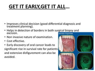 VELSCOPE: ASSESSMENT SYTEM FOR ORAL CANCER SCREENING | PPTX