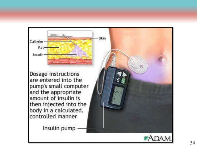 Intelligent Drug Delivery System | PPTX