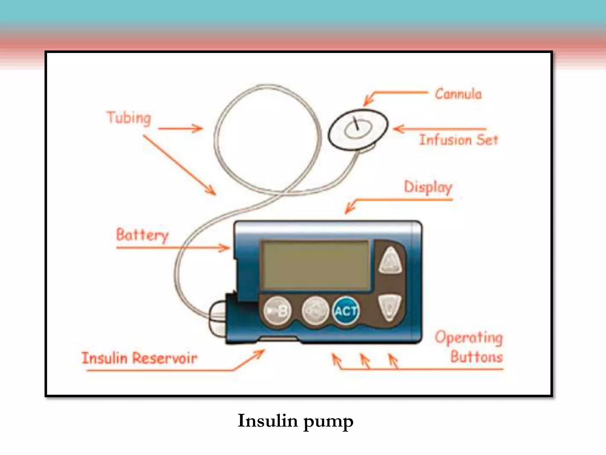 Intelligent Drug Delivery System | PPTX