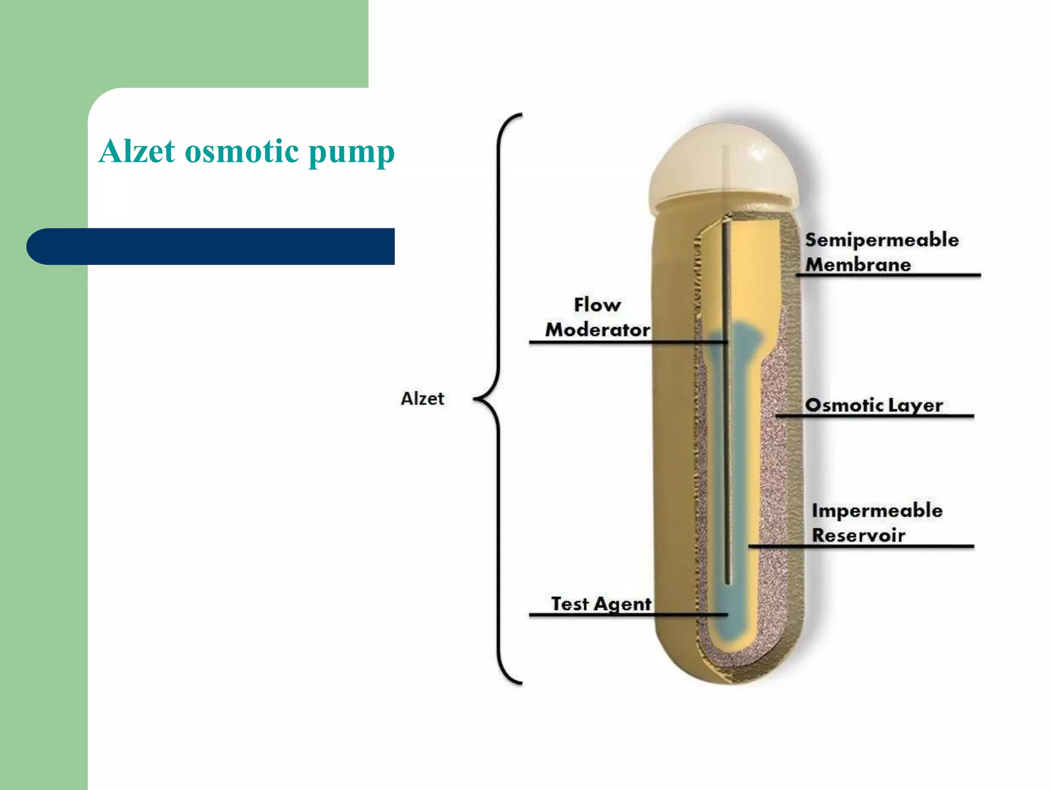 Implantable drug delivery system | PPTX