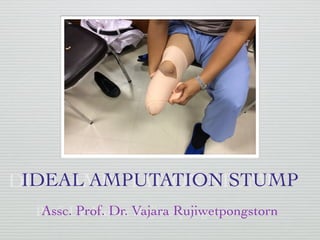 Ideal amputation stump presentation slide.pdf