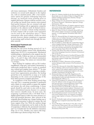 Ideal implant positioning 1 | PDF