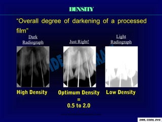 Ideal radiograph | PPT