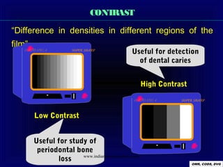Ideal radiograph | PPT
