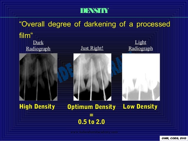 Ideal radiograph