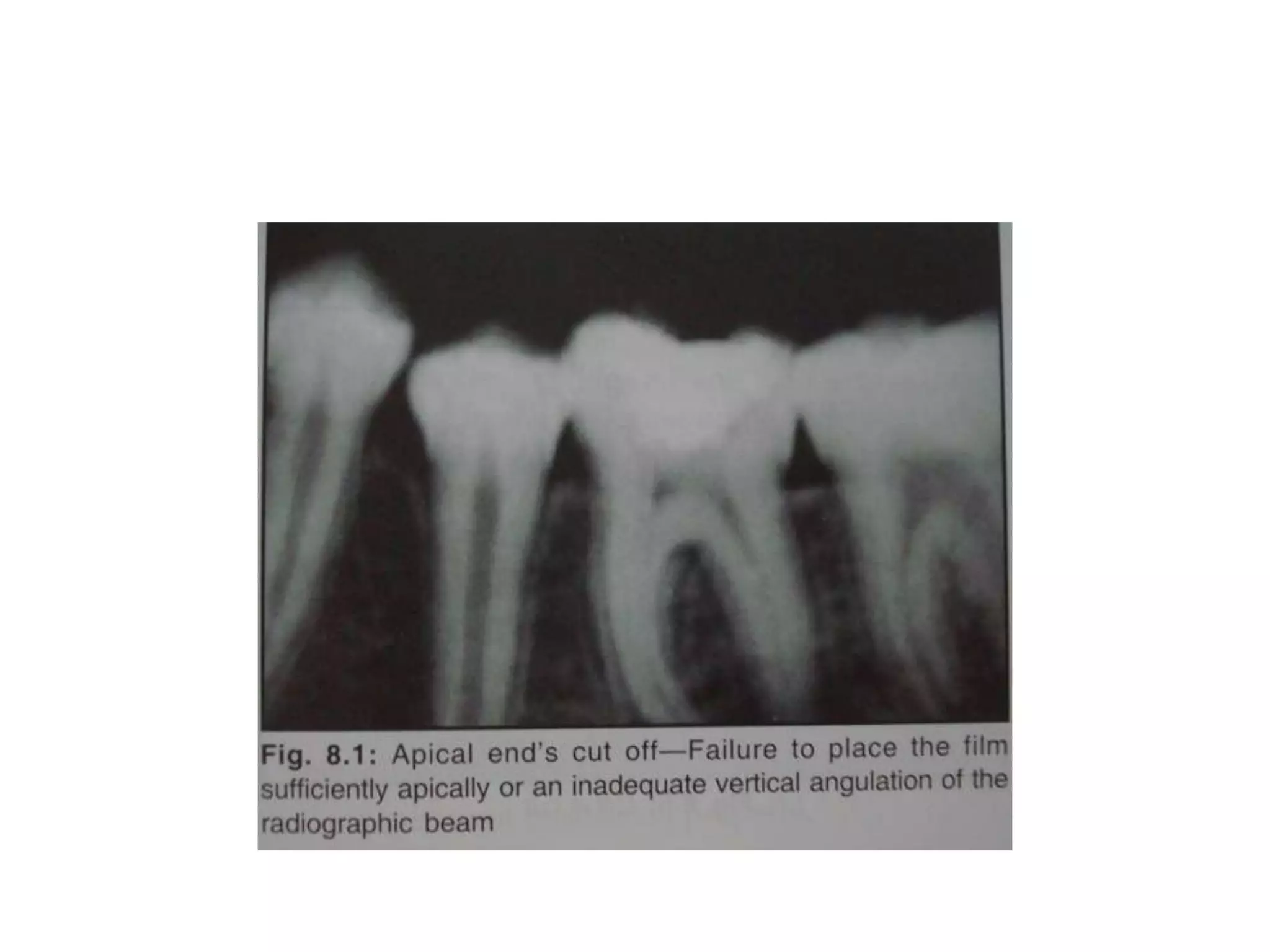 IDEAL RADIOGRAPH 1.pptx