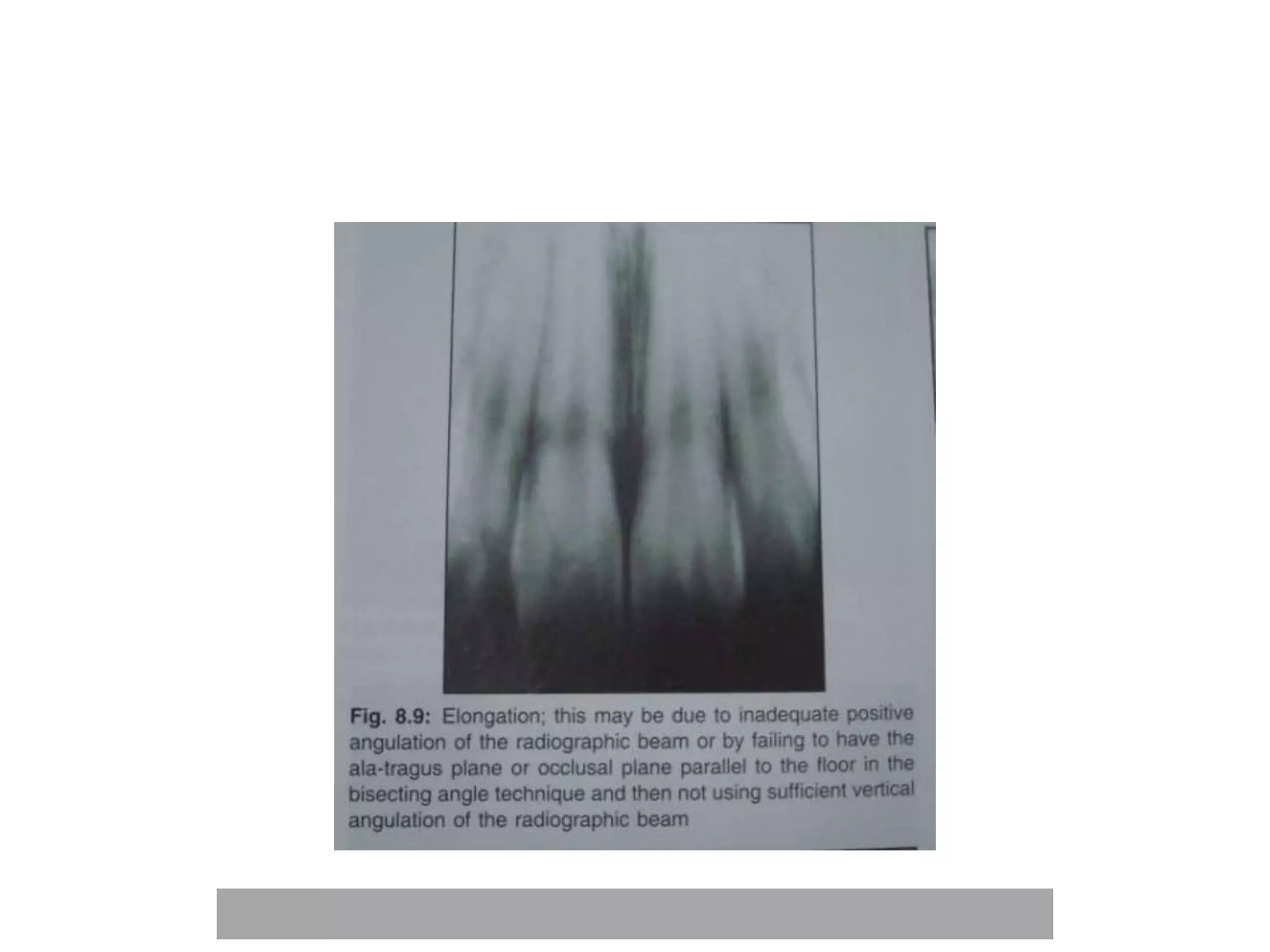 IDEAL RADIOGRAPH 1.pptx