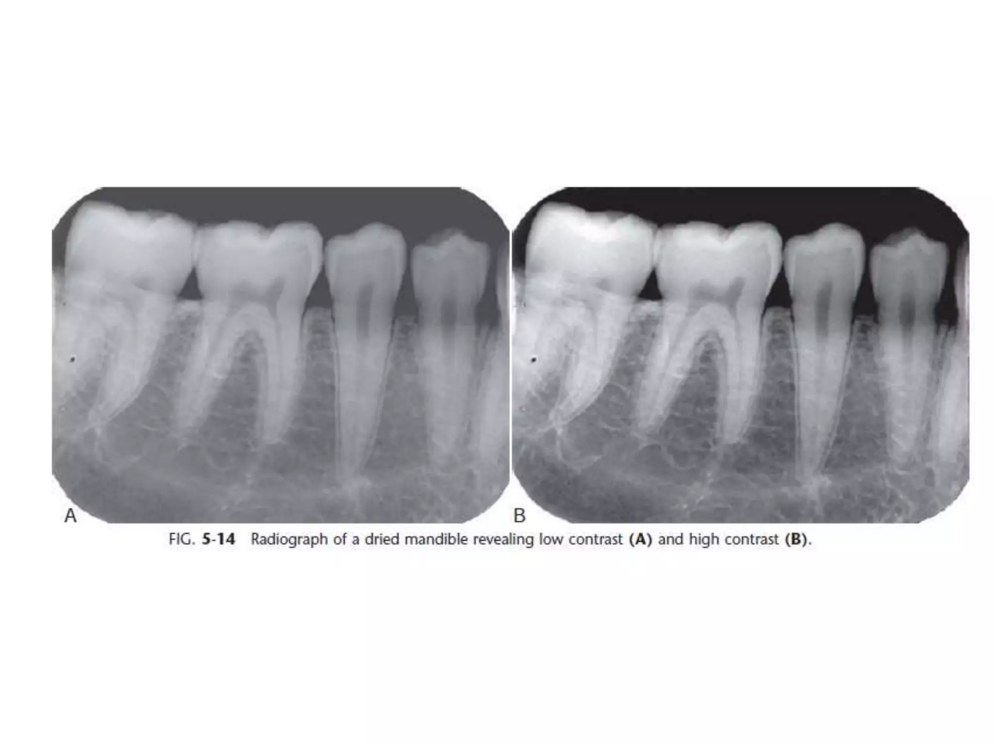 Ideal radiography | PPTX