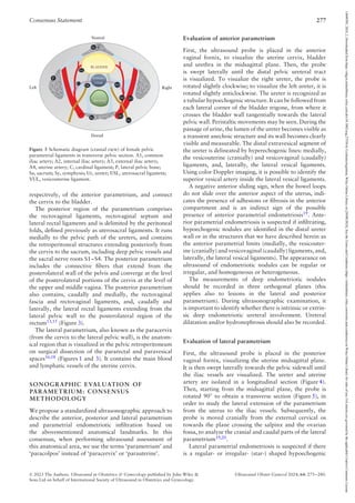 IDEA Parametrio Ultrasound in Obstet Gyne - 2023 - Guerriero - Addendum ...