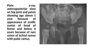 identifcation of bones by x-ray - Copy.pptx