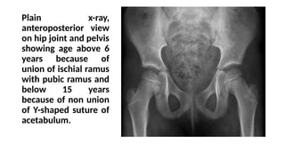 identifcation of bones by x-ray - Copy.pptx