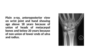 identifcation of bones by x-ray - Copy.pptx