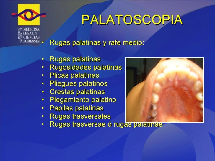 Identificación dental l