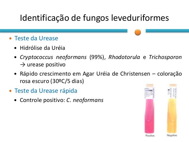 Identificação convencional de fungos filamentosos1