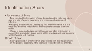 Identification-Scars and Tattoos.pptx