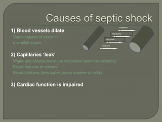 Identification and recognition of sepsis | PPTX