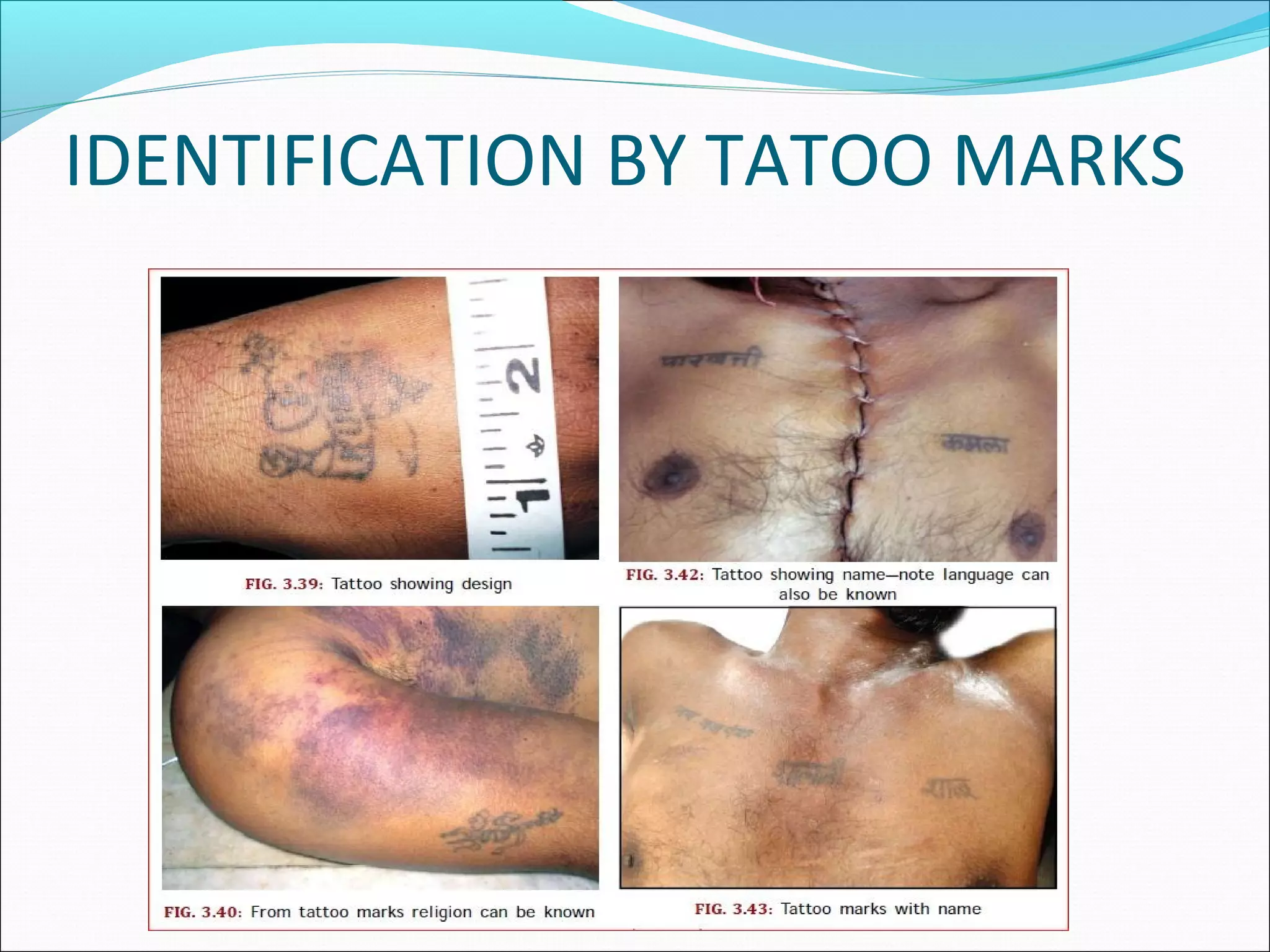 IDENTIFICATION BY SCARS, TATOO MARKS, FINGER PRINT, FOOT PRINTS , SHOE ...