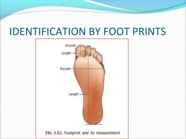 IDENTIFICATION BY SCARS, TATOO MARKS, FINGER PRINT, FOOT PRINTS , SHOE ...