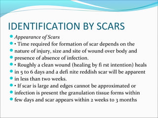 IDENTIFICATION BY SCARS, TATOO MARKS, FINGER PRINT, FOOT PRINTS , SHOE ...