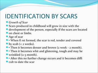 IDENTIFICATION BY SCARS, TATOO MARKS, FINGER PRINT, FOOT PRINTS , SHOE ...
