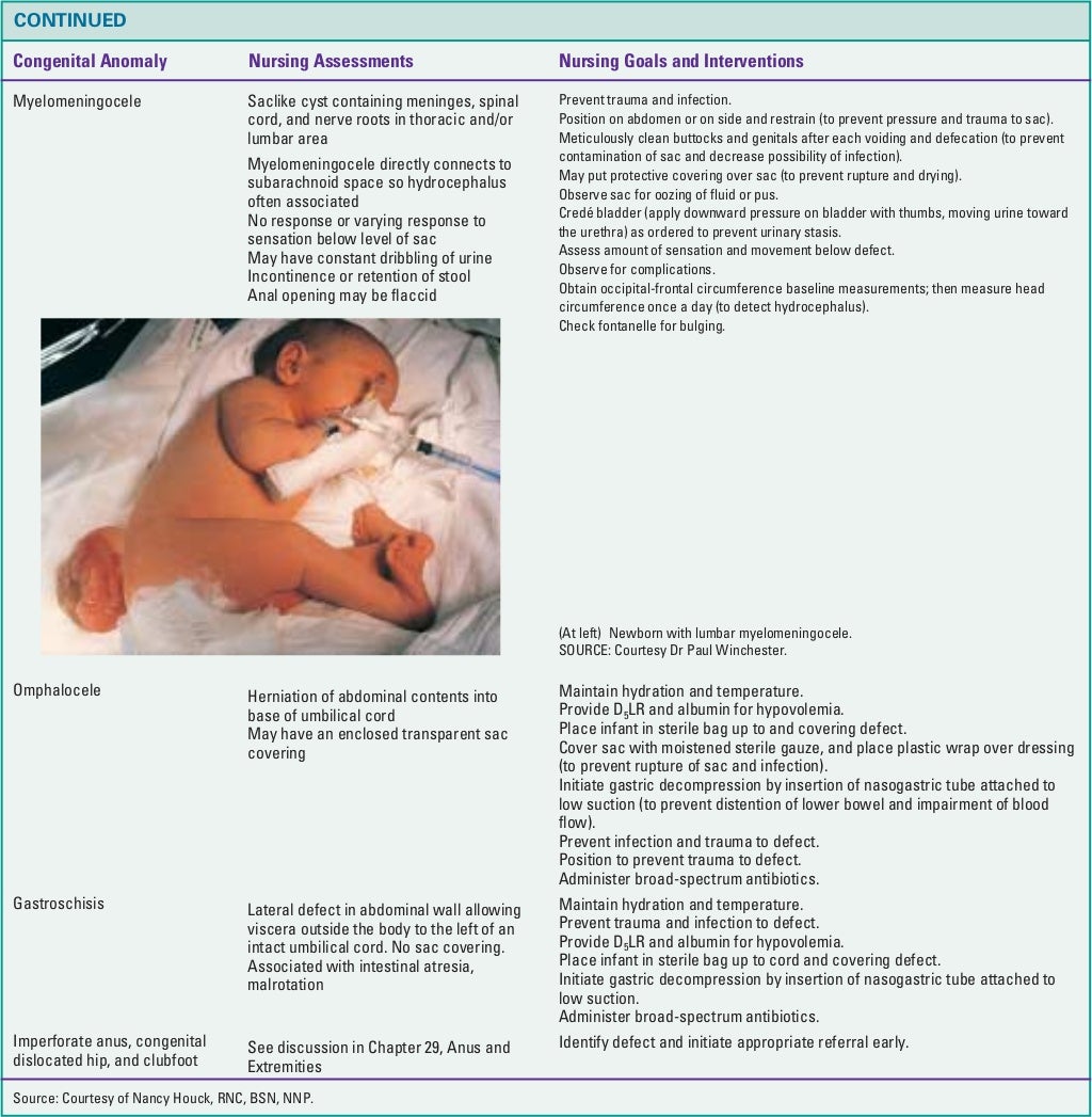 Identification & nursing management of common congenital malformations ...